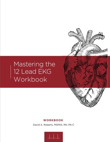 Mastering the 12 Lead EKG Workbook: Roberts, David: 9780999836316 ...