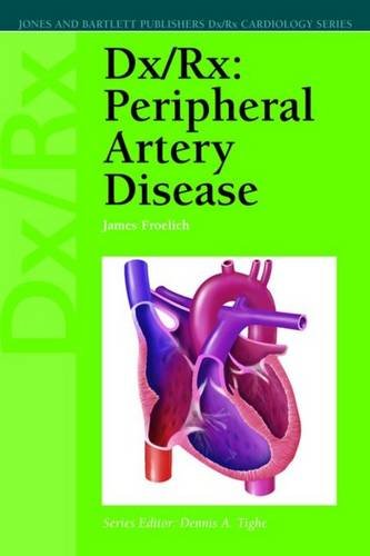 Dx/Rx: Peripheral Artery Disease: Froelich, James: 9780763724795 ...