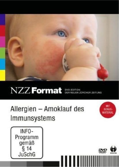 Amazon.com: Allergien - Amoklauf des Immunsystems, DVD : Movies & TV