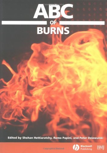 ABC of Burns (ABC Series Book 111) eBook : Hettiaratchy, Shehan, Papini ...