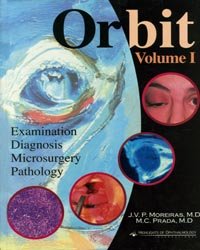 ORBIT: Examination Diagnosis Microsurgery Pathology Vol 1 : Amazon.co ...