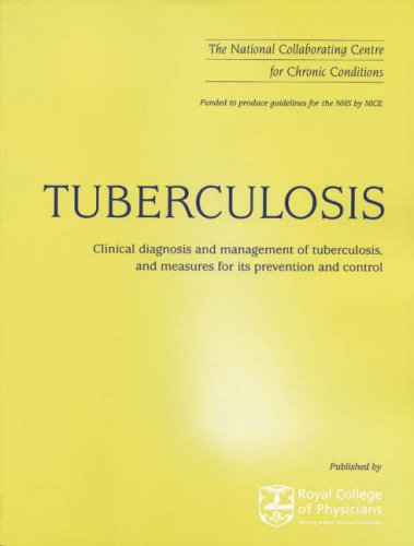 Buy Tuberculosis: Clinical Diagnosis and Management of Tuberculosis and ...