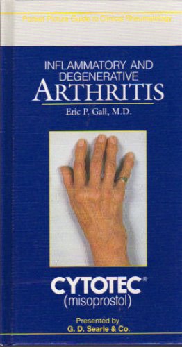 Inflammation and Degenerative Arthritis (Pocket Picture Guide to ...