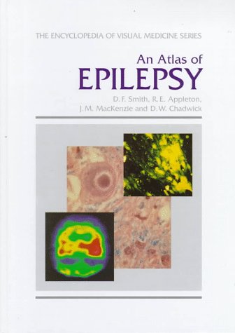 An Atlas of Epilepsy: 9781850704881: Amazon.com: Books