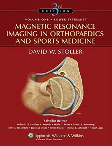 Magnetic Resonance Imaging In Orthopaedics And Sports Medicine 3Ed 2 ...