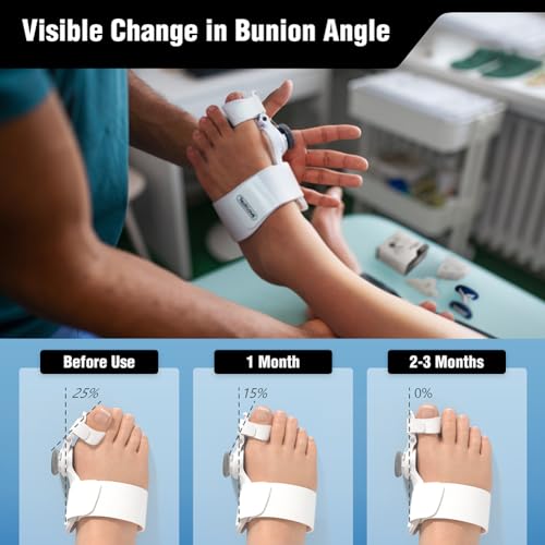 Tech Love Bunion Corrector Big Toe Straightener – Day & Night Kit – 1 x ...