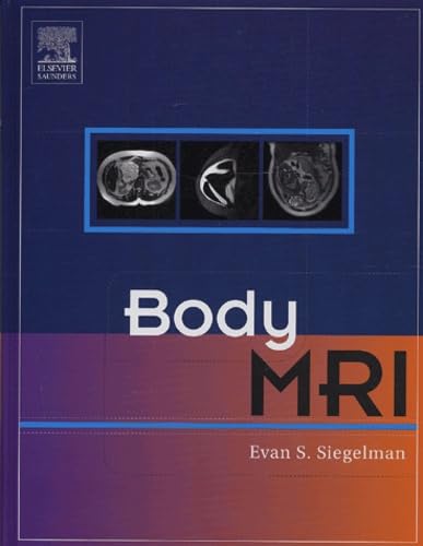 Body MRI: 9780721637402: Medicine & Health Science Books @ Amazon.com