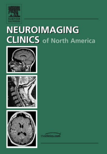 Buy Neuroimaging: 3.0t Vs.1.5t: An Issue of Neuroimaging Clinics: v. 16 ...