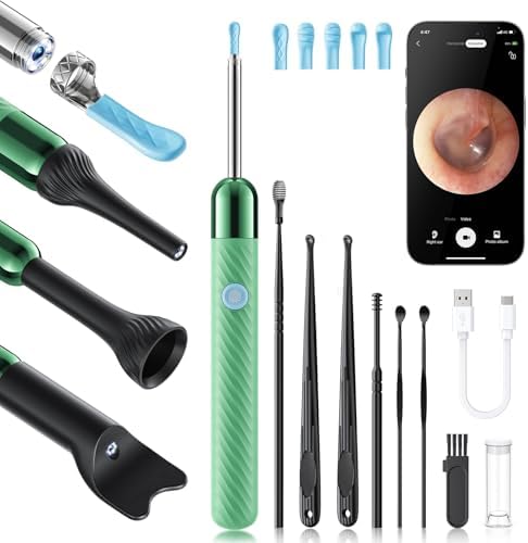 Amazon.com: Ear Wax Removal Tool Camera Otoscope with Light, Ear Wax ...