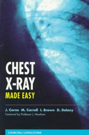 Chest X-Ray Made Easy: 9780443051944: Medicine & Health Science Books ...