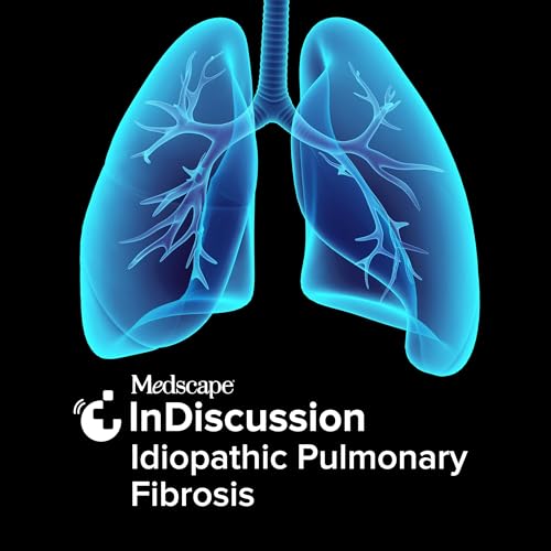 Amazon.com: Medscape InDiscussion: Idiopathic Pulmonary Fibrosis ...