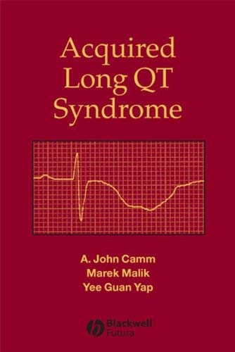 Amazon.com: Acquired Long QT Syndrome eBook : Camm, A. John, Malik ...
