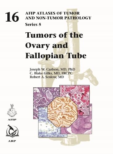 Tumors of the Ovary and Fallopian Tube (AFIP Atlas of Tumor and Non ...