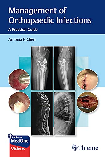 20 Best Orthopaedics Books of All Time - BookAuthority