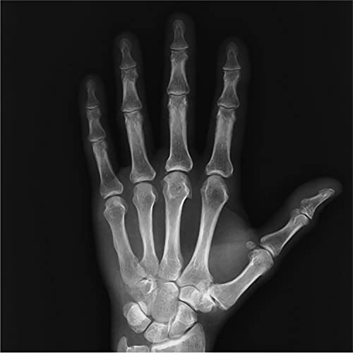 VMS HI-Speed conventional X-Ray Medical Film Blue Base Sensitive 8 inch ...