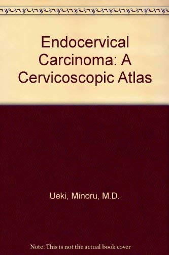 Amazon | Endocervical Carcinoma: A Cervicoscopic Atlas | Ueki, Minoru ...