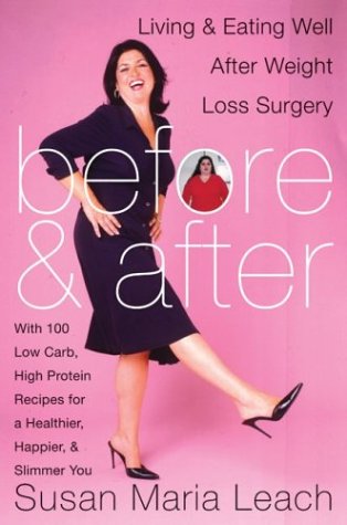 Before and After: Living and Eating Well After Weight Loss Surgery ...