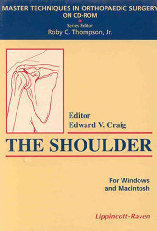 Buy Shoulder (Master Techniques in Orthopaedic Surgery) Book Online at ...