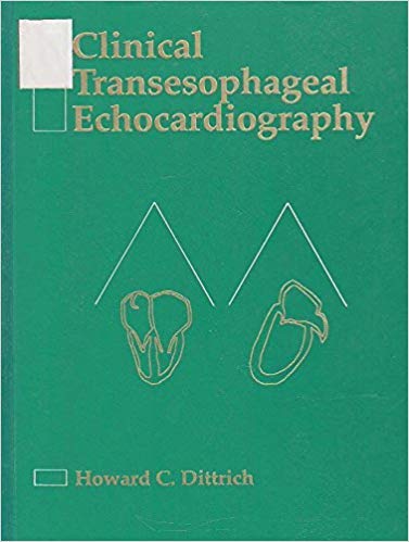 Clinical Transesophageal Echocardiography : Dittrich, Howard: Amazon ...