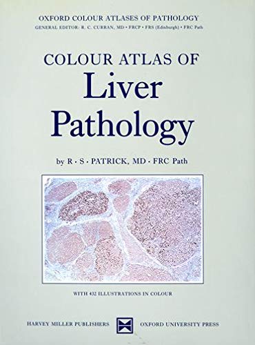 Amazon | Color Atlas of Liver Pathology: Oxford Color Atlases of ...