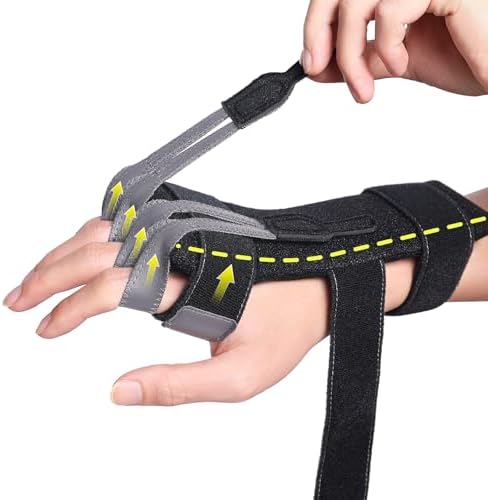 Amazon.com: Radial Nerve Palsy Brace Splint for Finger Extension, Wrist ...