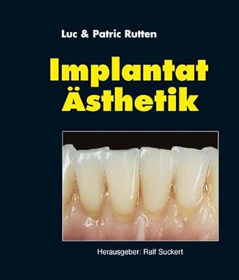 Implantat-Ästhetik : Luc & Patrick Rutten: Amazon.de: Bücher