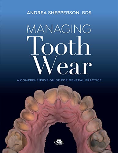 Managing Tooth Wear: A comprehensive guide for general practice ...