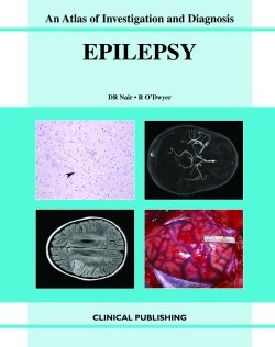 Epilepsy: An Atlas of Investigation and Management: 9781904392545 ...