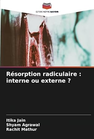 Buy Résorption radiculaire: interne ou externe ? Book Online at Low ...