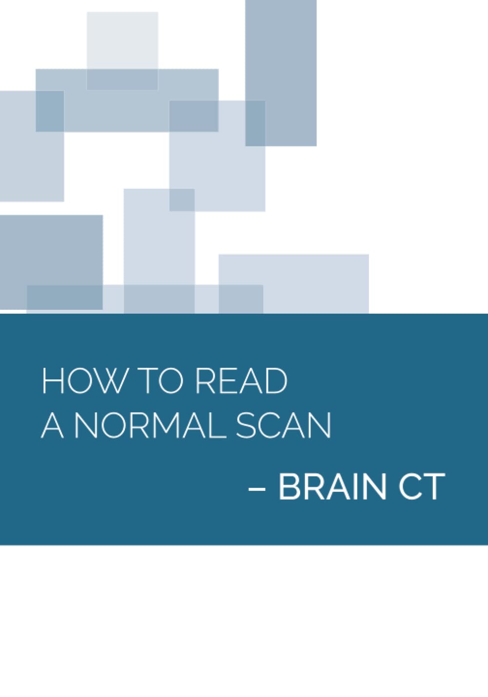Buy How to Read a Normal Scan : Brain CT (NEURORADIOLOGY: How to Read a ...