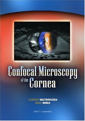 Buy Confocal Microscopy of the Cornea Book Online at Low Prices in ...