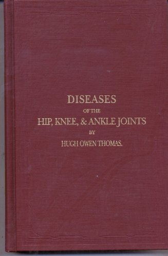 Buy Diseases of the Hip, Knee, & Ankle Joints Book Online at Low Prices ...