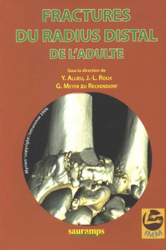 FRACTURES DU RADIUS DISTAL DE L ADULTE : ALLIEU ROUX MEY, Allieu, Yves ...