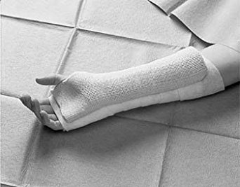 Amazon.com: 3M Health Care 30530 Primacast Unpadded Splint, 30" L x 5 ...