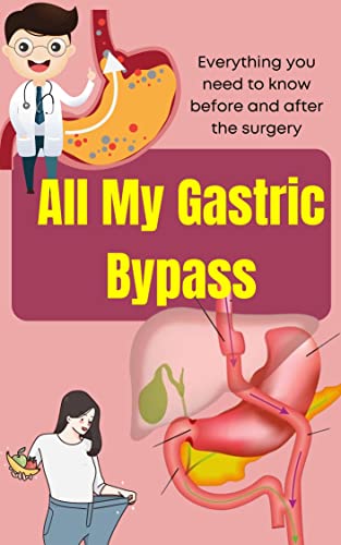 All My Gastric Bypass: All My Gastric Bypass Book, Easy Gastric Sleeve ...