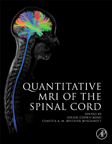 Quantitative MRI of the Spinal Cord: Amazon.de: DVD & Blu-ray