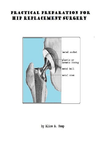 Amazon.com: Practical Preparation for Hip Replacement Surgery eBook ...