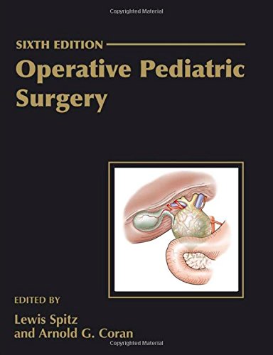Amazon | Operative Pediatric Surgery 6Ed | Spitz, Lewis, Coran, Arnold ...