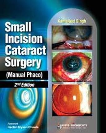 Small Incision Cataract Surgery: Manual Phaco: 9788184489804: Medicine ...