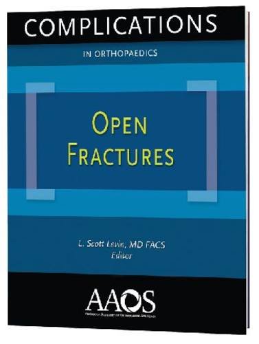 Open Fractures (Complications in Orthopaedics): 9780892036394: Medicine ...