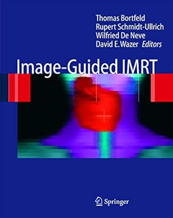 Buy Image-Guided IMRT Book Online at Low Prices in India | Image-Guided ...