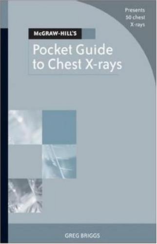 McGraw-Hill's Pocket Guide to Chest X-rays: 9780074713365: Medicine ...