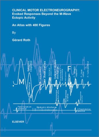 Clinical Motor Electroneurography: Evoked Responses Beyond the M-Wave ...