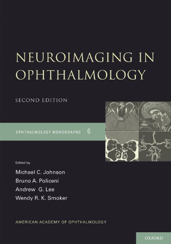 Amazon.com: Neuroimaging in Ophthalmology (American Academy of ...