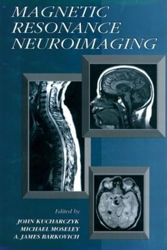 Magnetic Resonance Neuroimaging: 9780849347191: Medicine & Health ...