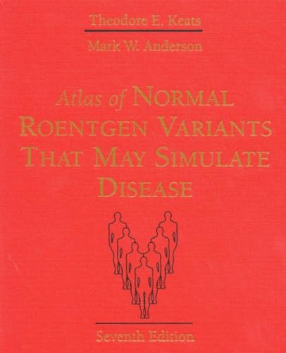 Atlas of Normal Roentgen Variants That May Simulate Disease ...