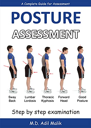 Amazon.com: POSTURE ASSESSMENT: Step by step examination eBook : Malik ...
