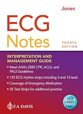 ECG Notes: Interpretation and Management Guide: 9781719641944: Medicine ...