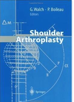 Shoulder Arthroplasty - | 9780387633497 | Amazon.com.au | Books