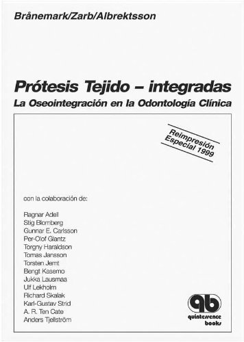 Prótesis Tejido - integradas: La Oseointegración En La Odontología ...